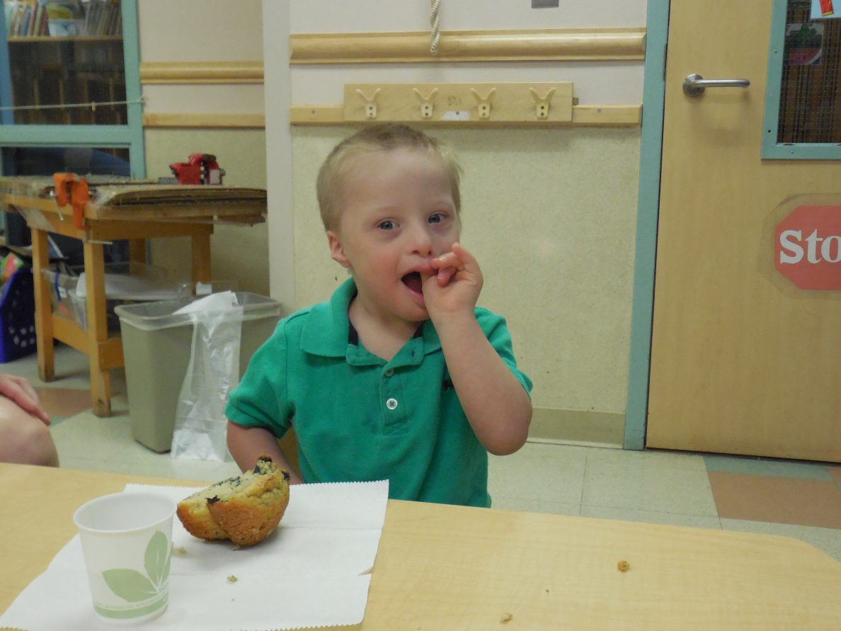 Food texture key to eating habits in children with Down syndrome ...