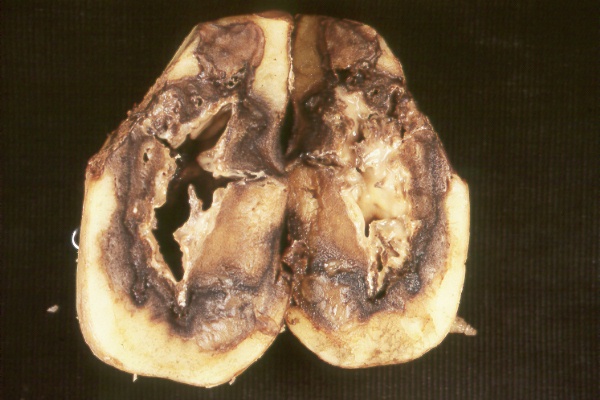 Potato | Pacific Northwest Vegetable Extension Group | Washington State ...