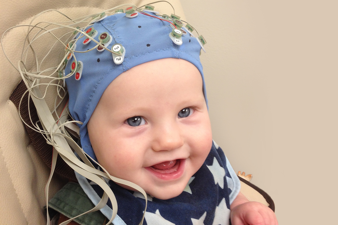 Eeg Cap Child