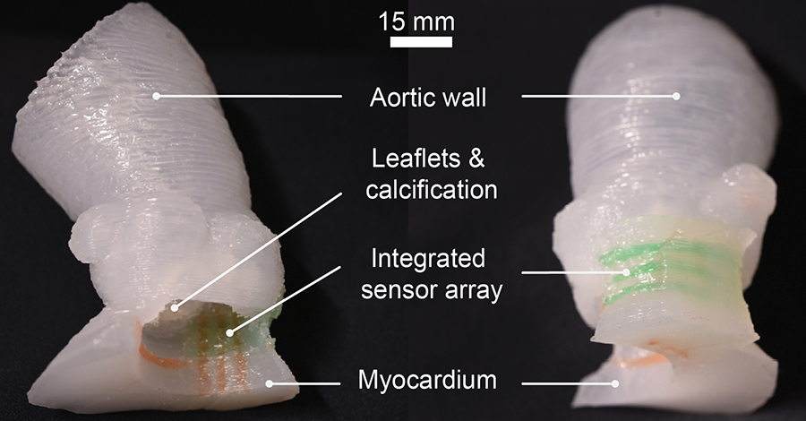 Researchers 3D print lifelike heart valve models | WSU Insider ...