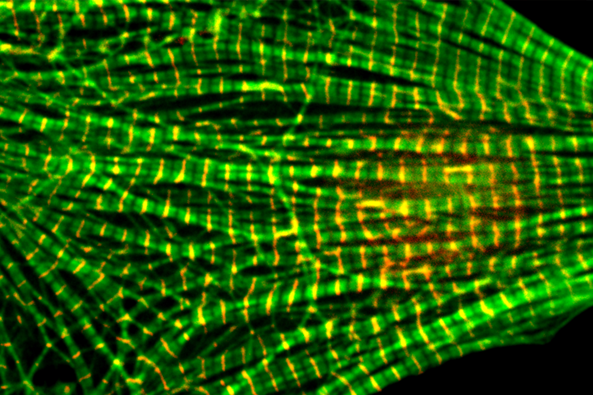 Study shows a molecular dance that keeps your heart beating | WSU ...