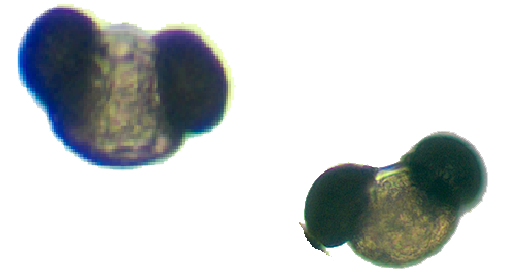 Intense pollen levels and wind seeding misery, irritation | WSU Insider ...